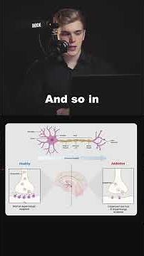 The mechanism behind addiction #addictionrecovery #dopamine #addiction