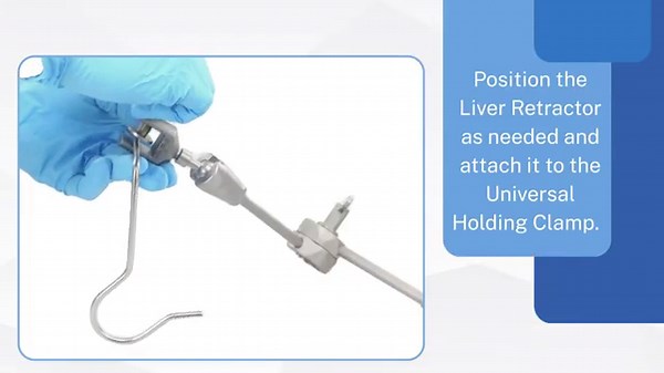 Nathanson Retractor Systems: Set up and use