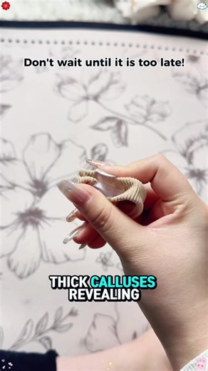 #bunion #corrector #foot #health #tiktokshop