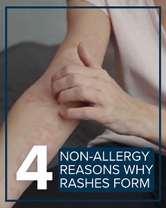 46K views · 79 reactions | When your skin comes into contact with an allergen, you may develop a rash. But there are many other reasons rashes can develop. Here’s when to seek medical attention: https://bit.ly/4629OjW | Advocate Health Care | Facebook