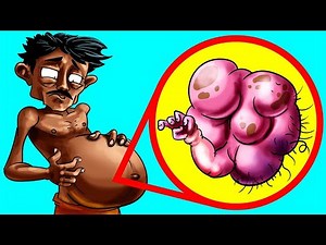 15 Strange Craziest Things Found in Human Body