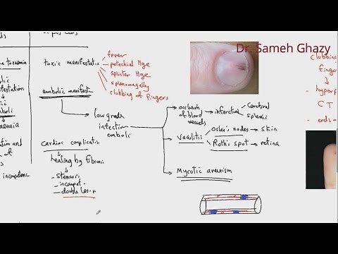 Systemic pathology 4 : CVS (infective and non-infective endocarditis) DR.SAMEH GHAZY