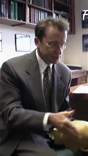 This video breaks down skull sutures, how the brain compensates for growth, and surgical corrections. Learn about potential complications and what to watch for. A must-watch for parents and medical professionals alike. #SkullSutures #BrainCompensation #Surgery #Medical #Health From: Little Miracles Series 01 Episode 11 | Real Families