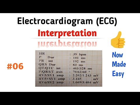 How to Read an ECG (interpretation) | 06 QRS Complex