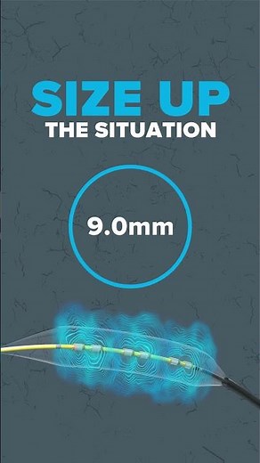 Size Up the Situation with Shockwave L6 Peripheral IVL Catheter