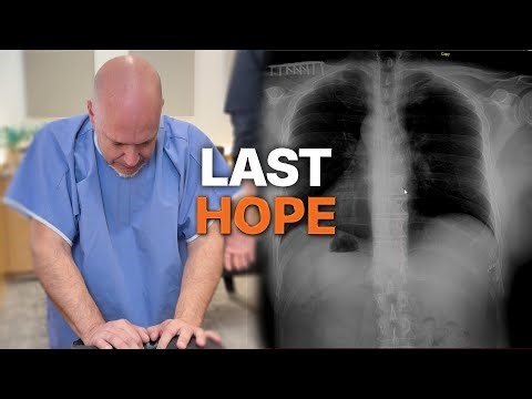 He Tried EVERYTHING for Mid-Back Pain… This Was His Last Hope (Part 1)