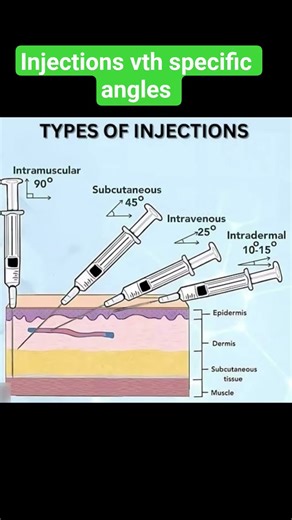 Types of injection sites
