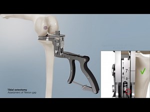 Mathys: balanSys UNI Surgical technique – Ligament Tensor