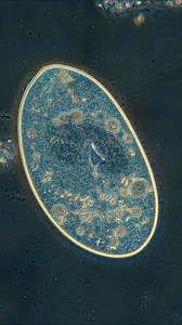 1.5K views · 1.9K reactions | The univers inside a single cell. I will never cease to be amazed at the incredible complexity that can be contained in something so tiny. Paramecium sp. . . . . #science #universe #biology | Science into Images | Facebook
