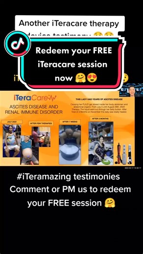 iTeracare THz Frequency - PH on TikTok