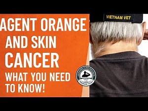 Agent Orange and Skin Cancer What You Need to Know!