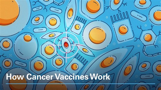 Cancer treatment vaccines are a form of immunotherapy aimed at enhancing the immune system’s ability to recognize and attack cancer cells. Learn more: https://bit.ly/3XzwWlK | Dana-Farber Cancer Institute