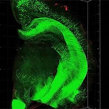 CLARITY: Cutting Edge Microscopy for Brain Imaging
