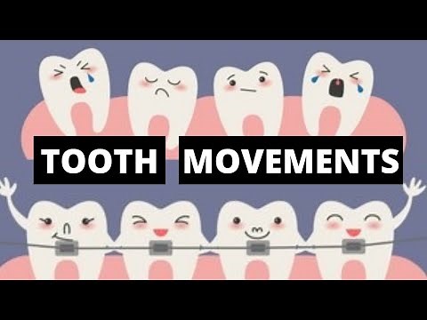 Types of Tooth Movements in Orthodontics