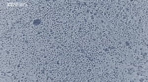 Coronavirus- Under the microscope | Davidson's Principles and Practice of Medicine