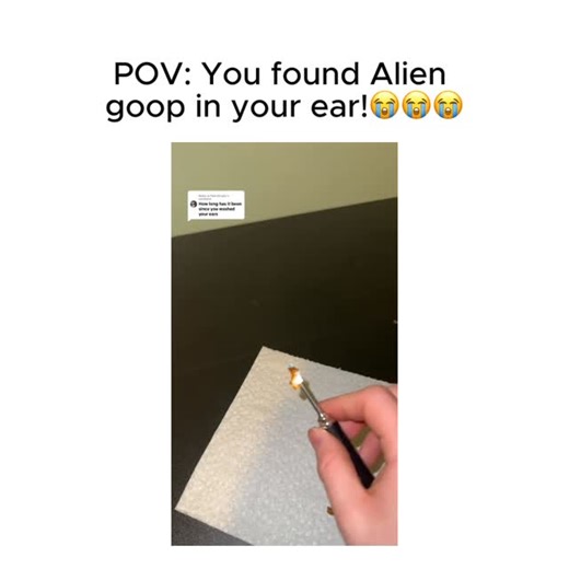 The Nebulae | The goop gots to go😂🙌#microsuction #hygiene #selfcare #healthy #earcleaning #gadgetreview #satisfying #hearingproblems #oddlysatisfying... | Instagram