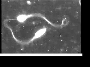 Human Spermatozoa (Dark field microscopy)