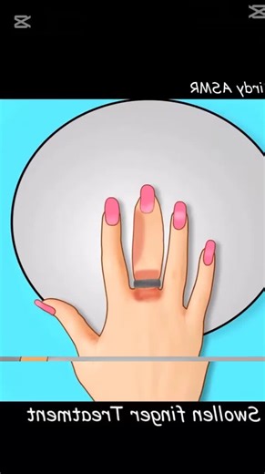 ASMR hand treatment remove Keratoses big hole & atopic dermatitis cleaning hand care 2d animation#animationtikto #ASMR #foryou #asmrsounds #animationtikto #asmrvideos