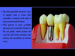 How does computer guided surgery work?