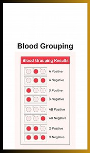 Not all blood types are the same. This is how blood grouping works (ABO & Rh). Educational content only. Save and share #BloodGrouping #ABOSystem #RhFactor #MedicalEducation #LabScience #HealthLearning #LaboratoryMedicine #EducationOnly | Dominion Medical