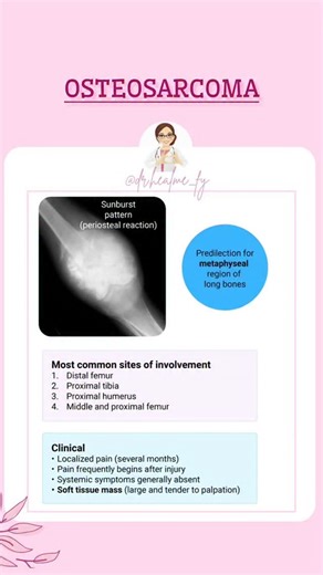 𝐃𝐫.𝐌𝐚𝐧𝐚𝐥𝐢 | 𝐇𝐄𝐀𝐋𝐓𝐇 & 𝐌𝐄𝐃𝐈𝐂𝐈𝐍𝐄 on Instagram: "🦴 Osteosarcoma The most common primary malignant bone tumor in adolescents and young adults 💥 Usually strikes at metaphysis of long bones — distal femur, proximal tibia, proximal humerus — where bones grow the fastest 🧠 Pathophysiology Malignant osteoblasts produce osteoid → destroy bone → cause periosteal elevation (Codman’s triangle). 📸 Radiology Hallmarks: ☀️ Sunburst appearance 🛡️ Codman’s triangle (lifted periosteum) ⚙️