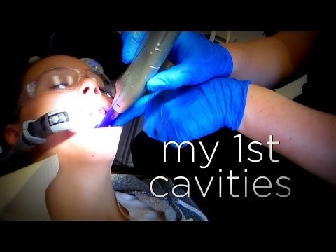 MY FIRST CAVITIES