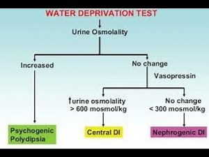 Water deprivation test (Miller Moses test); Definition, Procedure, Purpose, Interpretation of Result