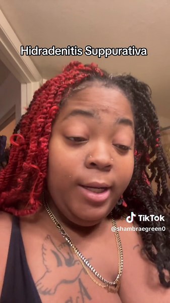 Ddrop what stage you have in the comment section #hidradenitissuppurativaawareness #fypシ゚viral #hswarrior #hidradenitissuppurativa #surgery #hs #boil #hidradenitis #hidradenitissuppurativasupport #cyst #fyp