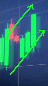 The Expert's Guide to Mastering Candlestick Trading Basics