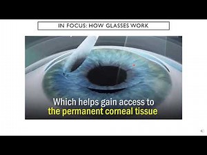 Introduction to Neuroscience 2: Lecture 2, The Eye