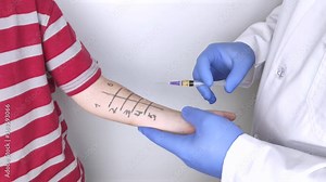 An allergist doctor makes a skin test for allergies. The boy is being examined in the laboratory, waiting for a reaction to allergens.