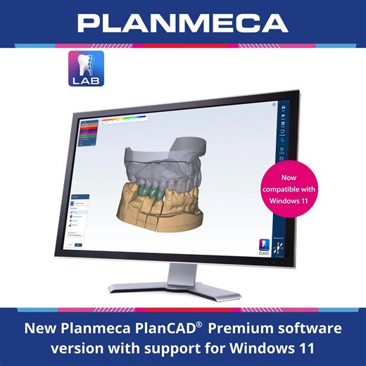 💻 Planmeca PlanCAD® Premium Software Supports Windows 11 The latest version of Planmeca PlanCAD® Premium software is available, now fully compatible with the Windows 11 operating system! ⚙️ This version introduces several powerful improvements to enhance CAD workflows in dental offices, laboratories and more! 👉 Click here to learn more about Planmeca PlanCAD®Premium! https://bit.ly/3COIjPT www.Planmeca.com #planmeca #PlanCad #DigitalDentistry #Windows11 #cadcam | Planmeca USA