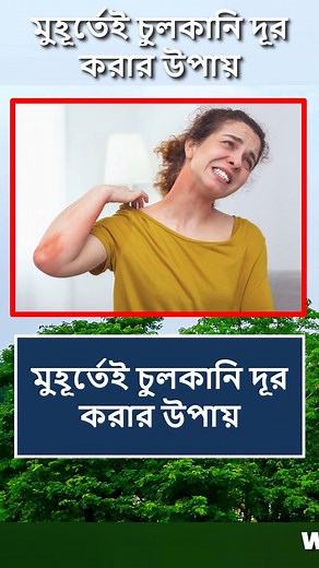 263K views · 2.6K reactions | মুহূর্তেই চুলকানি দূর করার উপায়  #Reels #fyp #reelsvideo #foryoupage #foryou #viralreels #reelsviral #reelsfb #trendingnow #itching | World Data Knowledge | Facebook