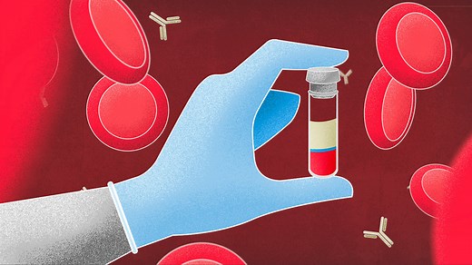 Does Covid-19 Infection Equal Immunity?