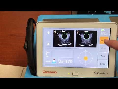 Caresono Padscan HD3 Bladder Scanner
