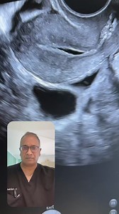 Struggling with fluid in the uterine cavity? Discover effective treatment options today for this challenging case . Are you dealing with fluid accumulation in the uterine cavity? Explore a range of effective treatment options tailored to your needs and take the first step towards better reproductive health. 🌸 #UterineHealth #FertilityTreatment #WomensHealth #HealthAwareness #WellnessJourney | Fertility Courses