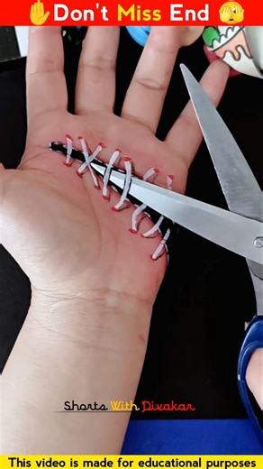✂️ Cutting My Stitches?! Hyper-Realistic 3D Hand Art Illusion 🎨 #shorts #illusion