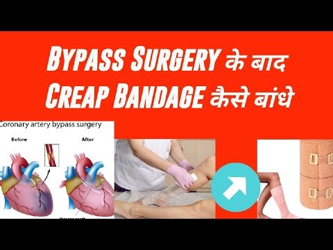 Bypass Surgery के बाद Creap Bandage कैसे और कब तक लगाए!