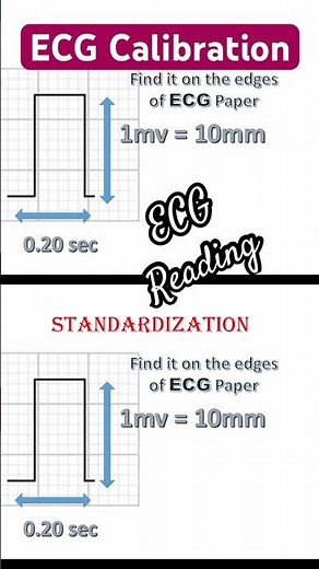 ECG paper Basic Calibration ll Medical Nerd #ecg #ecginterpretation #ecgs