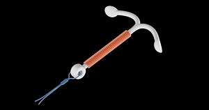 Intrauterine Kontrazeptiva. Nicht-hormonelle Kupfer T-förmige IUD: Stockvideos & Filmmaterial (100 % lizenzfrei) 3986452253 | Shutterstock