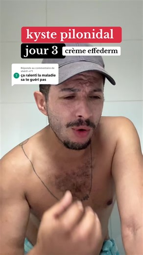 Comprendre le kyste pilonidal et ses implications