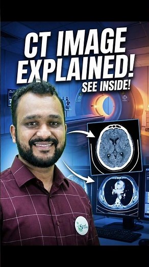 CT image Explained 🔥🔥 | #Medway