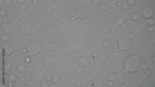 Microscopic view of moving human sperm cells with visible heads and flagella against a light background, commonly used in fertility and reproductive studies.
