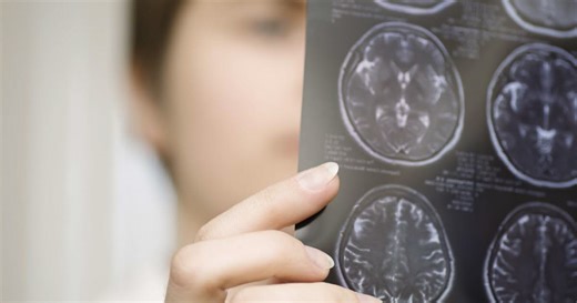 Santé. Un « point d'inflexion » du cerveau : l'adolescence s’achève à 32 ans, et c’est la science qui le dit