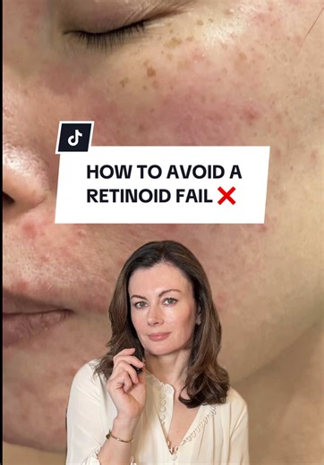 How to Get Retinoid Ready for Glowing Skin