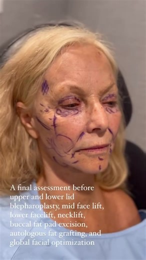 Global Surgical Facial Optimization Techniques