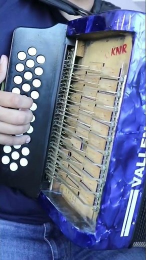 Así se ve un Acordeón por dentro