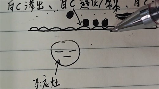 急性炎症反应中白细胞反应