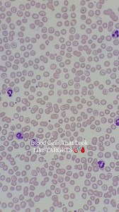 33K views · 229 reactions | Blood Cells That Look Like Targets 喝...