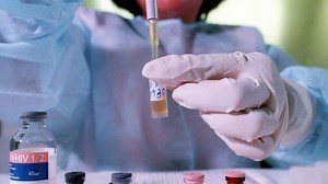 Highly Infectious, More Damaging HIV Variant Found in the Netherlands